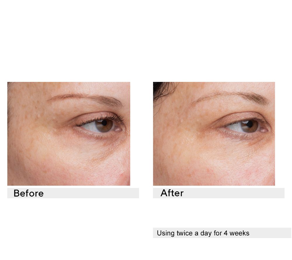 KORA Organics Berry Bright Vitamin C Eye Cream - QVC.com