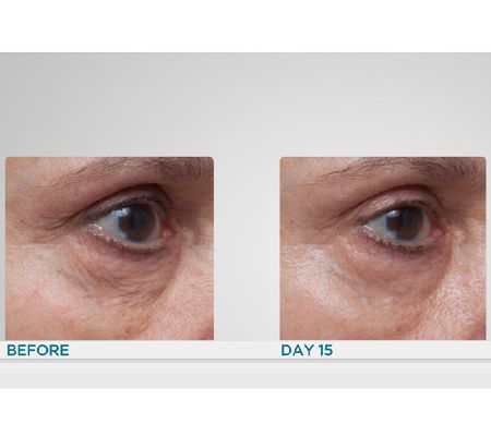 StriVectin Ageless 3-Piece Starter Kit - QVC.com