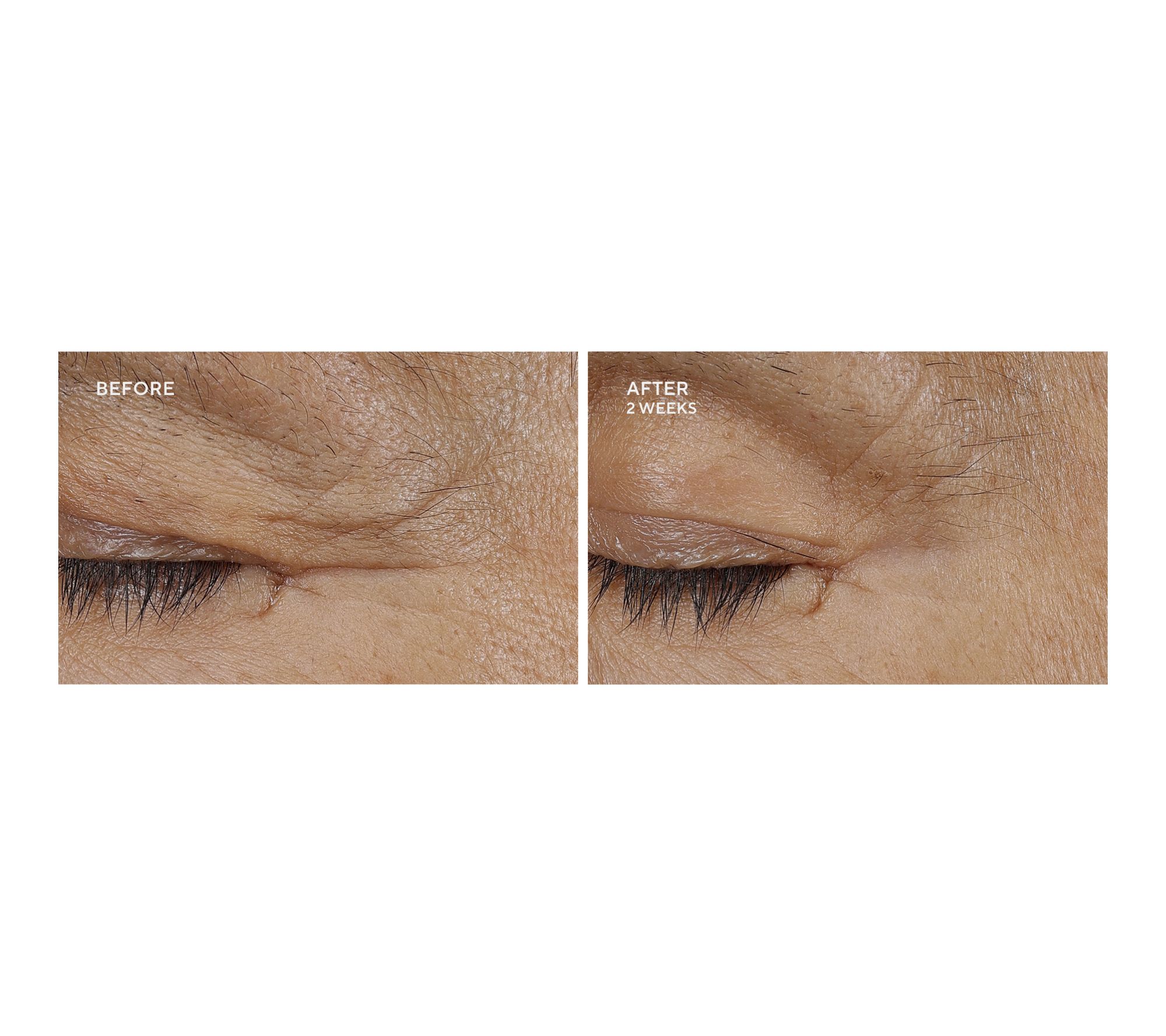 KAPLAN MD Pro Peptide Vibrating Eye Lift Wand & Refill Set - QVC.com