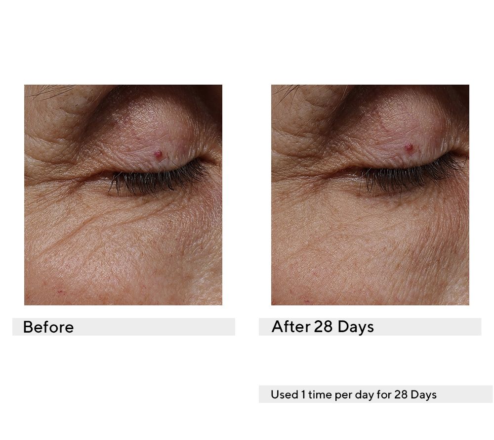 Dr. Denese 100-count Advanced Firming Facial Pads - QVC.com