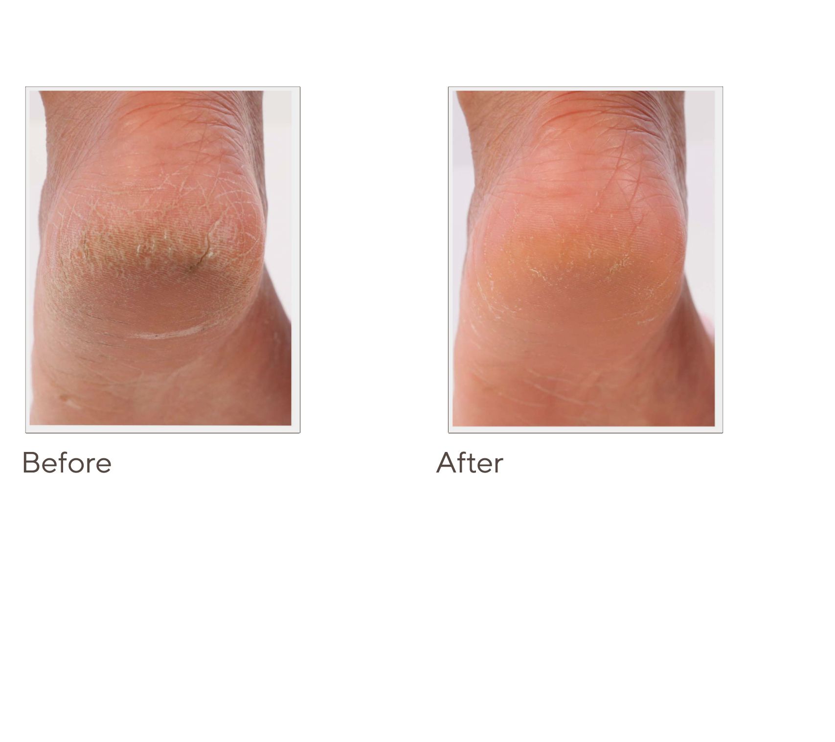 Spa-Rific Laser Etched Hardened Glass 3-Pc Mani-Pedi Set - QVC.com