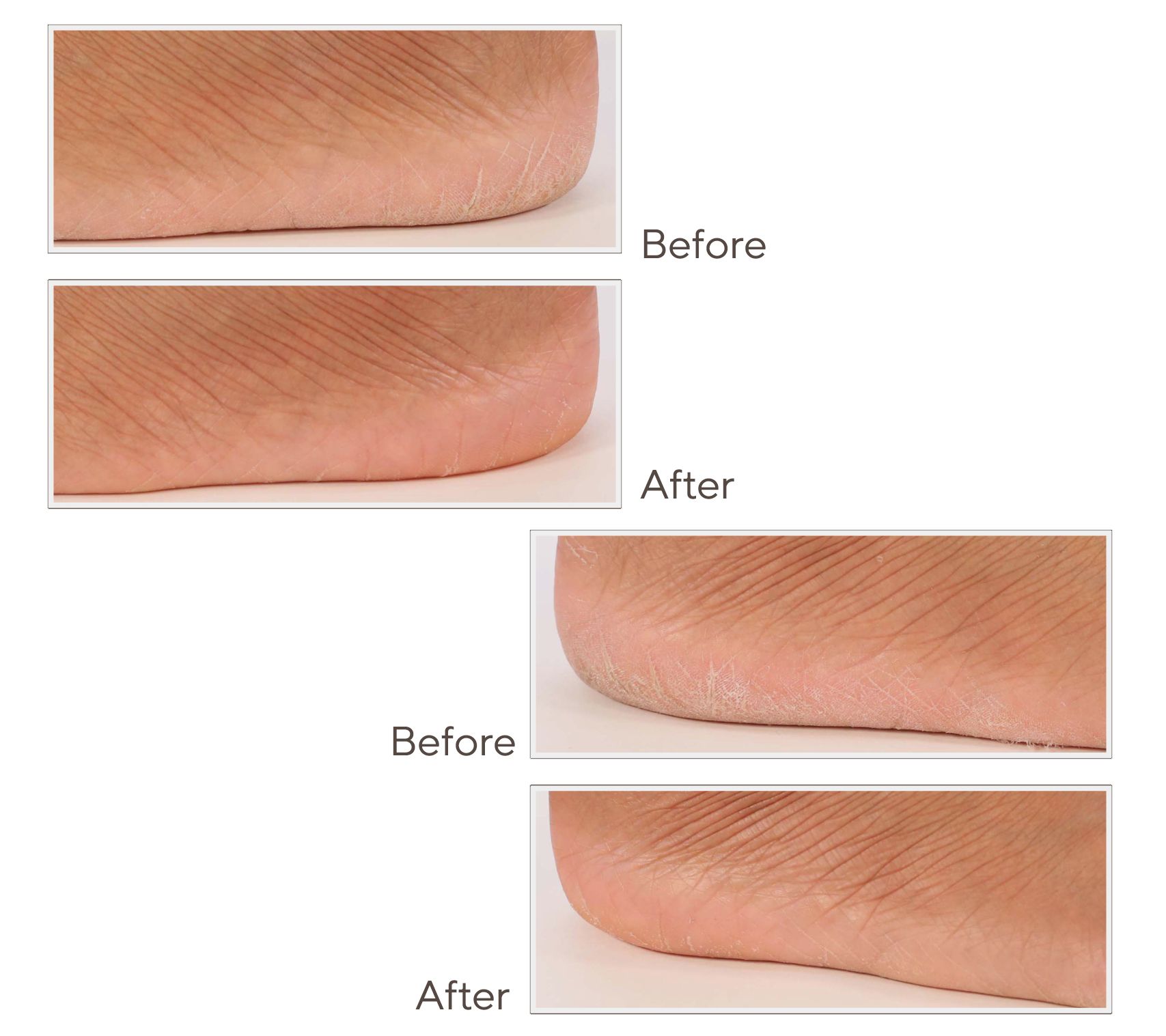 Spa-Rific Laser Etched Hardened Glass 3-Pc Mani-Pedi Set - QVC.com