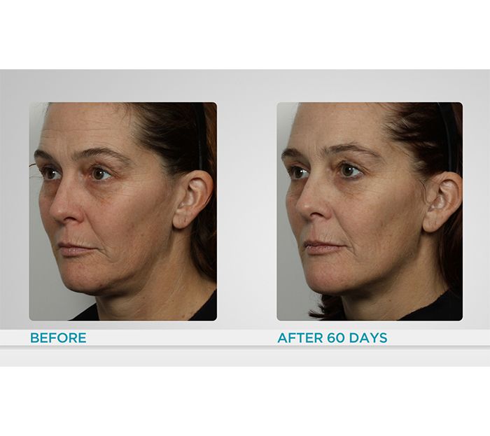 NuFACE Trinity Microcurrent Facial Toning Device with ELE - QVC.com