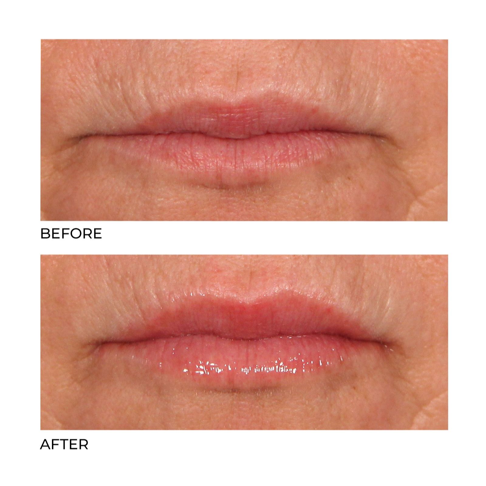 NassifMD Hydro-Screen for Lips Pink Champagne 4ml - QVC UK