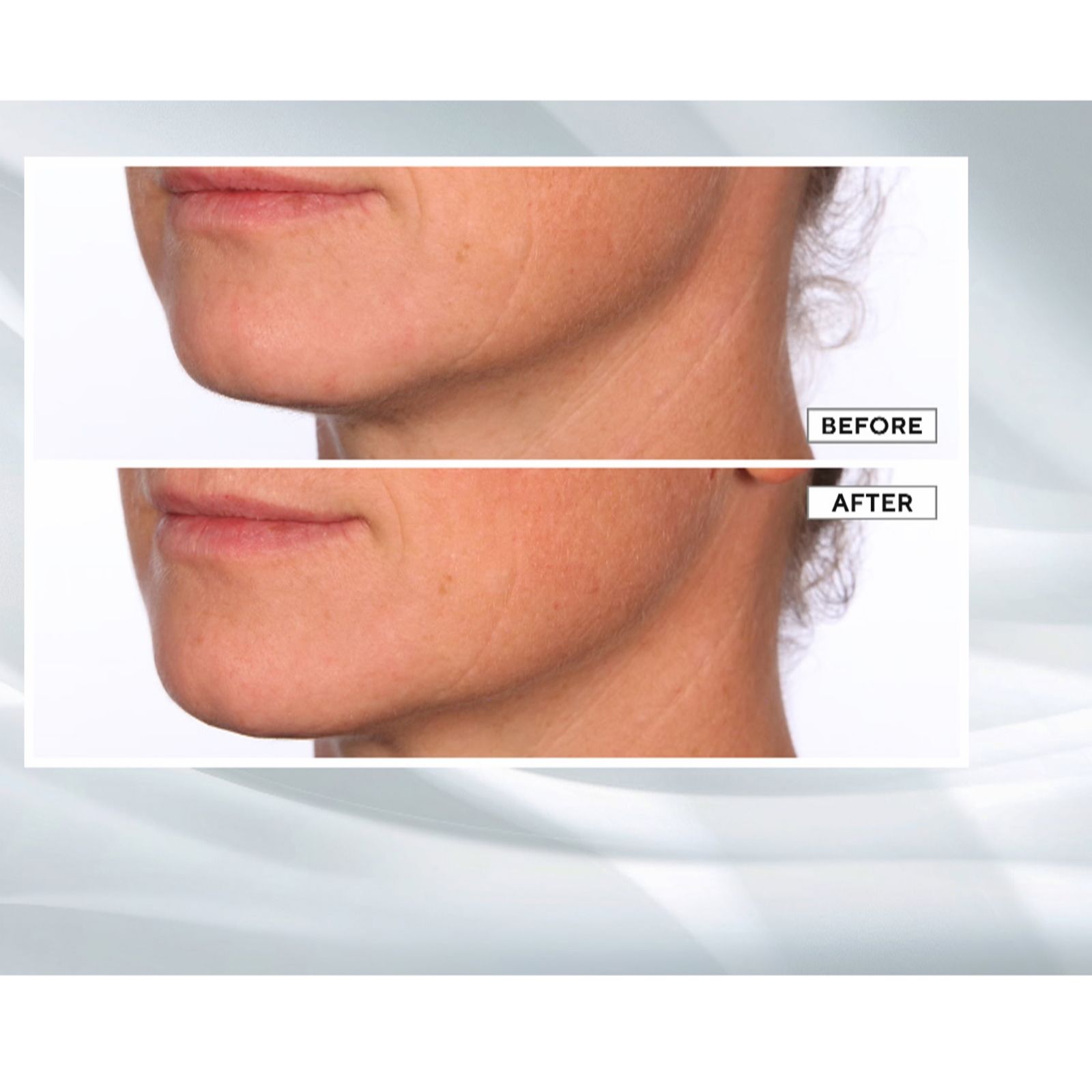 NassifMD 3 Piece Night Time Collection - QVC UK